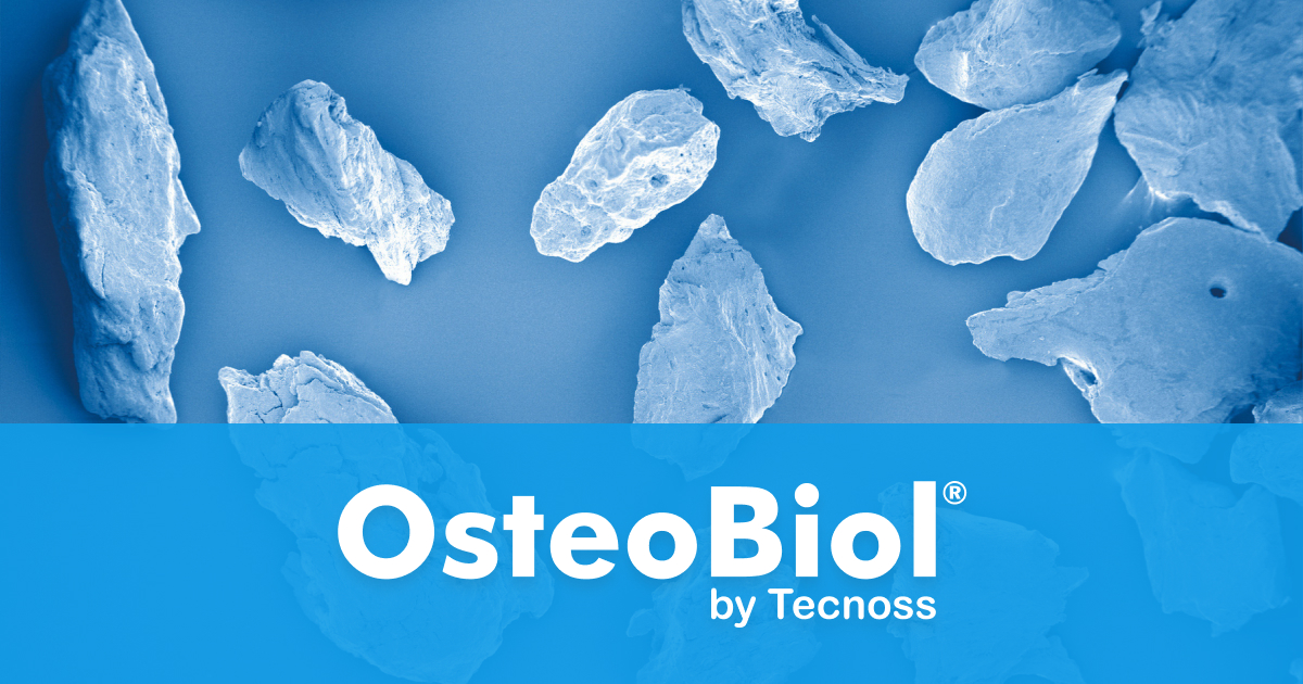 Extraction, guided bone regeneration and delayed guided implant ...